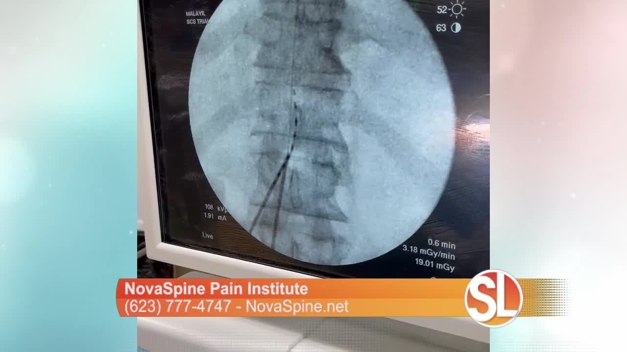 NovaSpine Pain Institute: Solutions for chronic back pain - YouTube