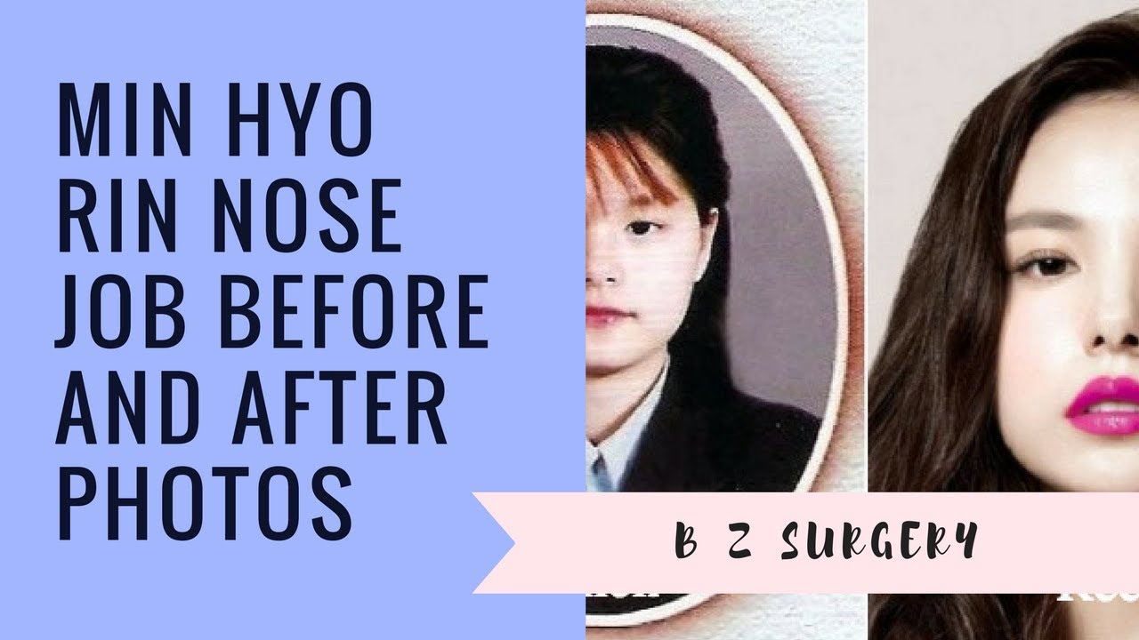 Min Hyo Rin Before And After