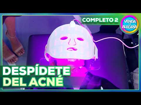 ¿Tienes problemas de acné? Te mostramos un tratamiento innovador 🧖🏻‍♀️✨ | Venga La Alegría