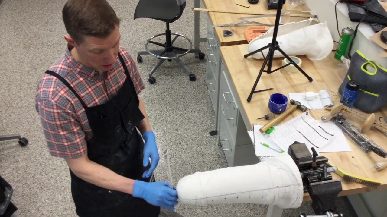 Transfemoral Cast Modification Part 1 - YouTube