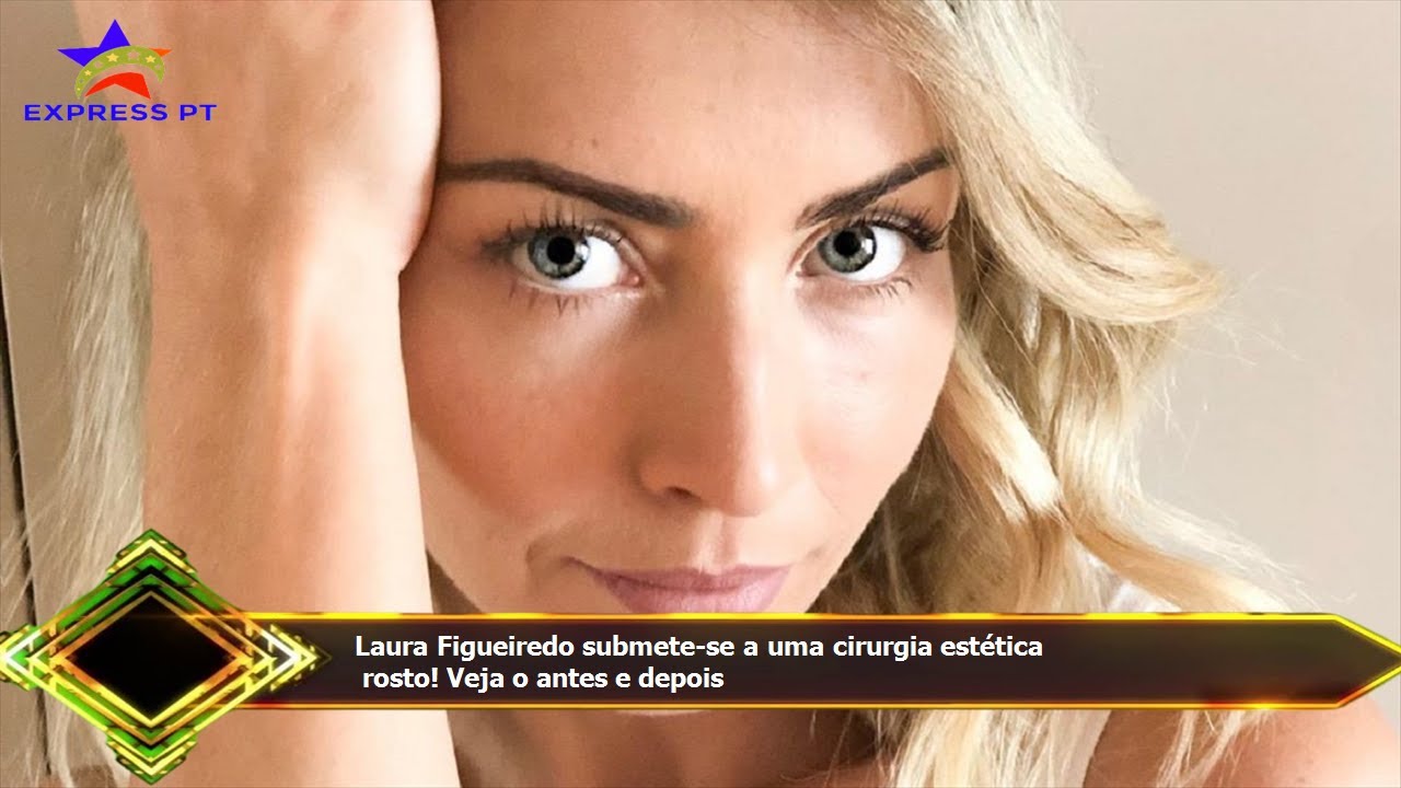 Laura Figueiredo submete-se a uma cirurgia estética rosto! Veja o antes ...