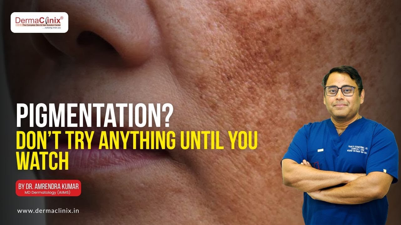 Pigmentation? Don't Try Anything Until You Watch | Dr Amrendra Kumar | DermaClinix - YouTube