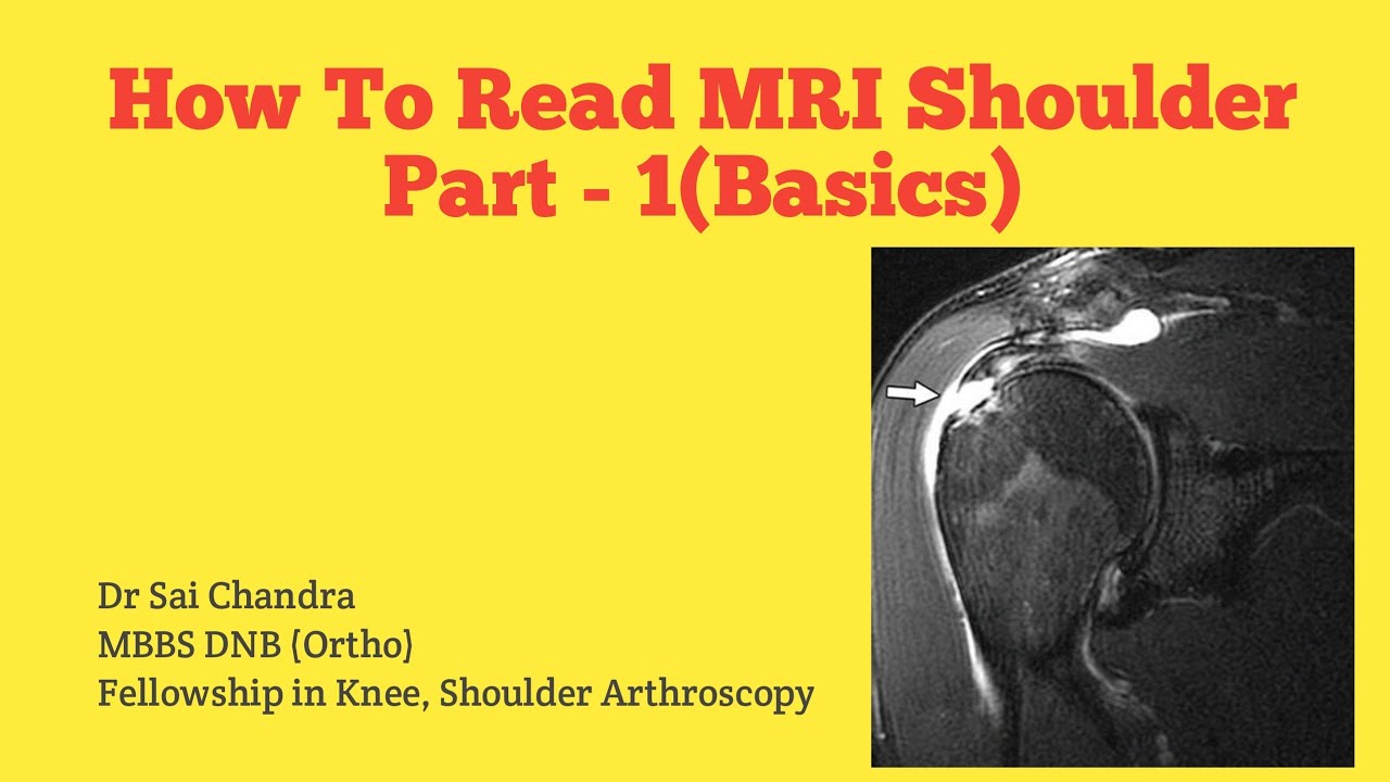 How To Read MRI Shoulder, Part - 1(Basics) ..Dr Sai Chandra MBBS DNB ...