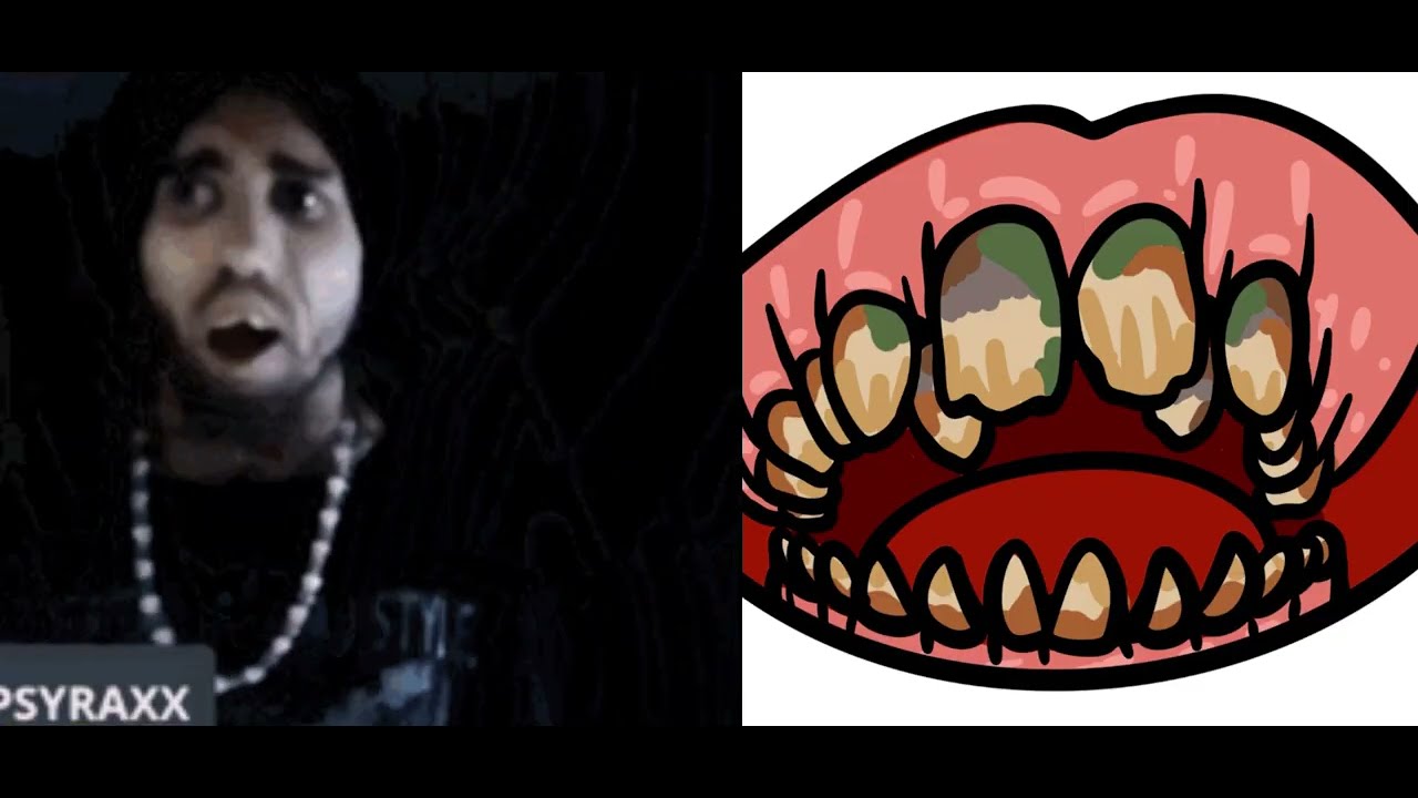 Cyraxx Case Study: His Teeth - YouTube