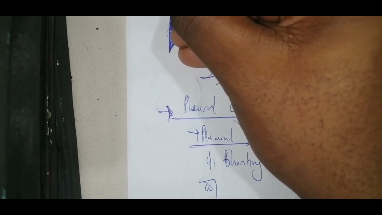 SchrDbb_Pathologic sign of Chest x-ray based on Pleurae and ...