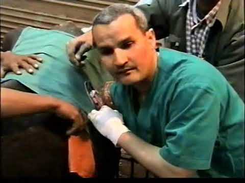 Rumenotomy in buffalo (Traumatic reticuloperitonitis) 🐃🐃🐃 part 1🐃🐃🐃 ...
