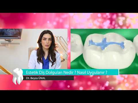 Estetik Diş Dolguları