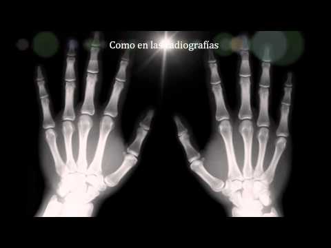 Marie Curie