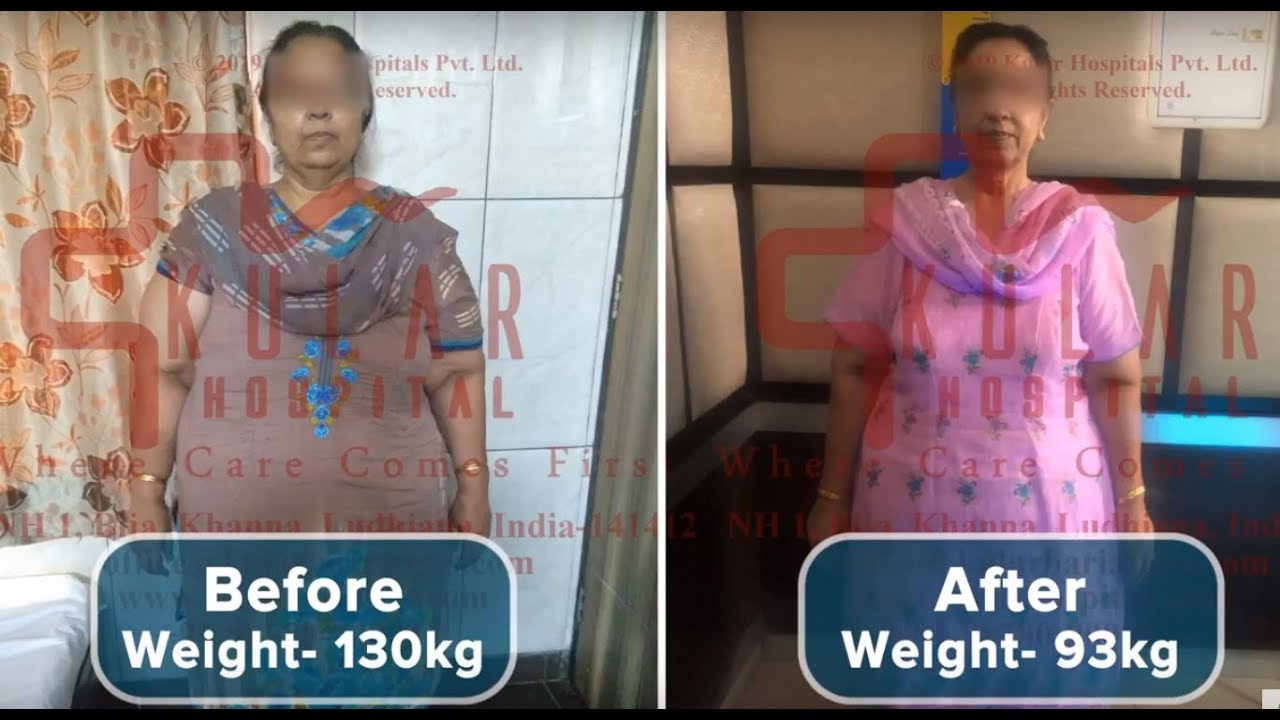 My Weight loss Transformation from 130 kg to 93 kg and Still Losing ...