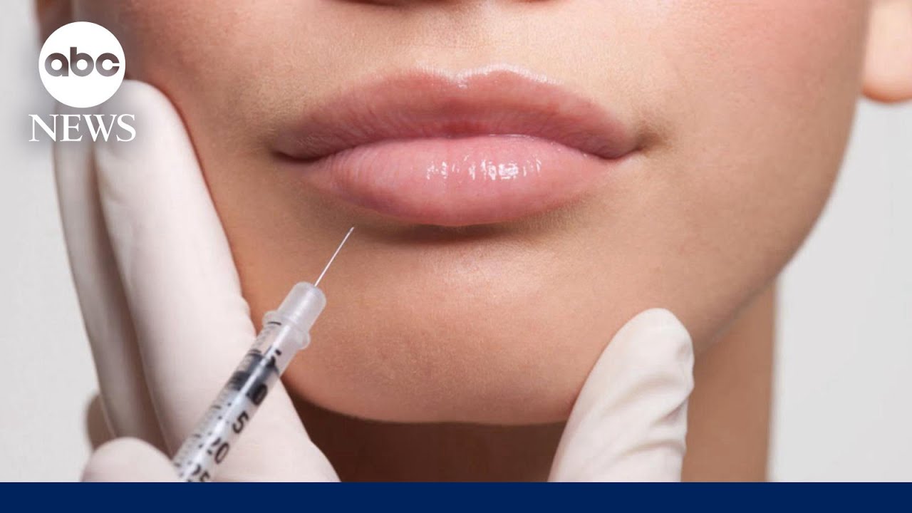 The rise of counterfeit botox - YouTube