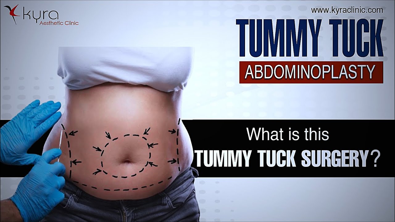Flat Stomach Goals: All About the Tummy Tuck Procedure in Ludhiana ...
