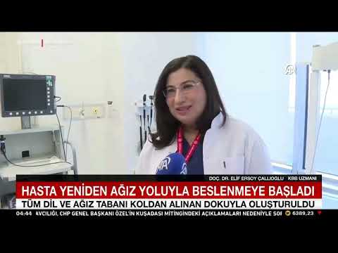 Kolundan alınan dokuyla hastanemizde dil ve ağız tabanı yapılan hasta yeniden konuşmaya başladı.