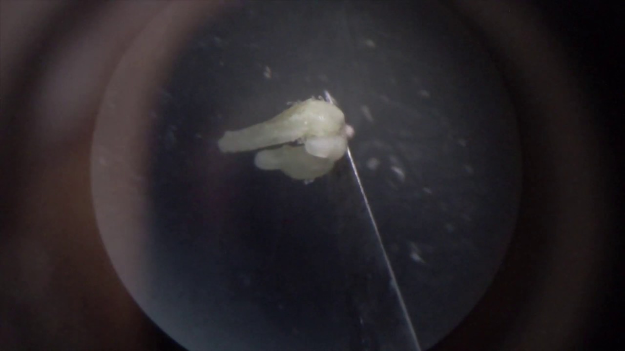 فصل ميرستيم البطاطس Potato Meristem Excision - YouTube