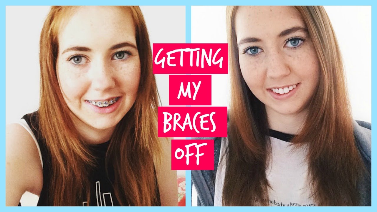 VLOG OF GETTING MY BRACES OFF AFTER 5 YEARS! - YouTube