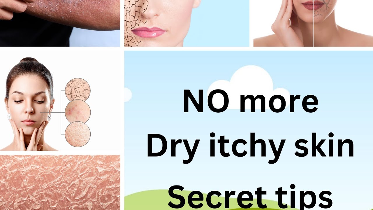 The surprising truth about dry itchy skin;causes revealed#how to get ...