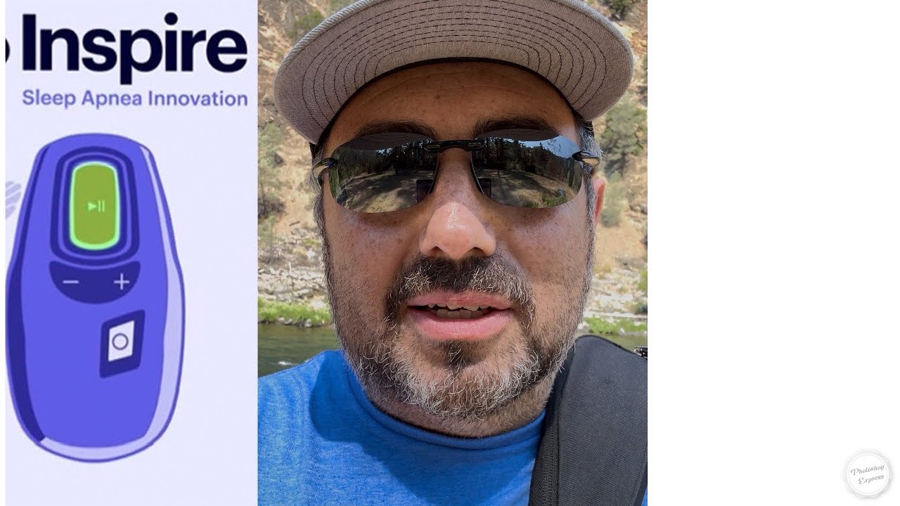 2 weeks after INSPIRE Sleep Apnea Implant Surgery! Up and moving around ...