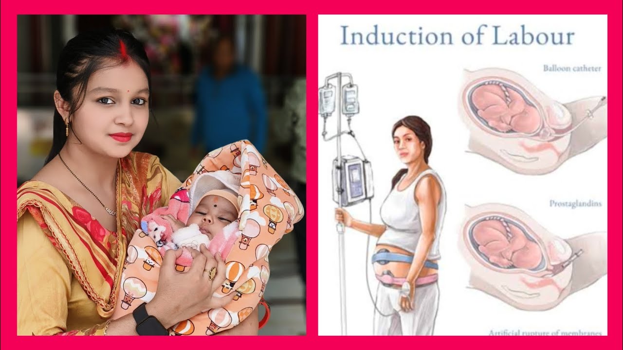 Induced / artificial labour pain journey 🥹 it's my first vlog ️ # ...