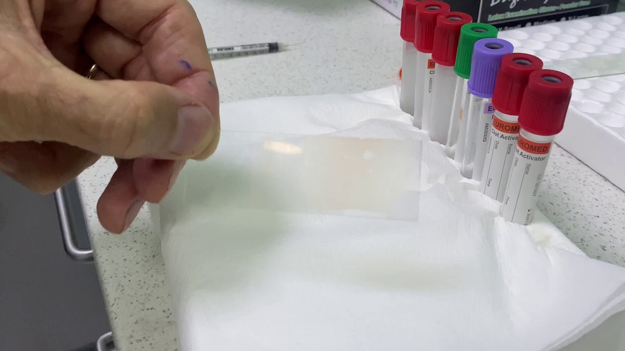 How to make a blood smear - YouTube
