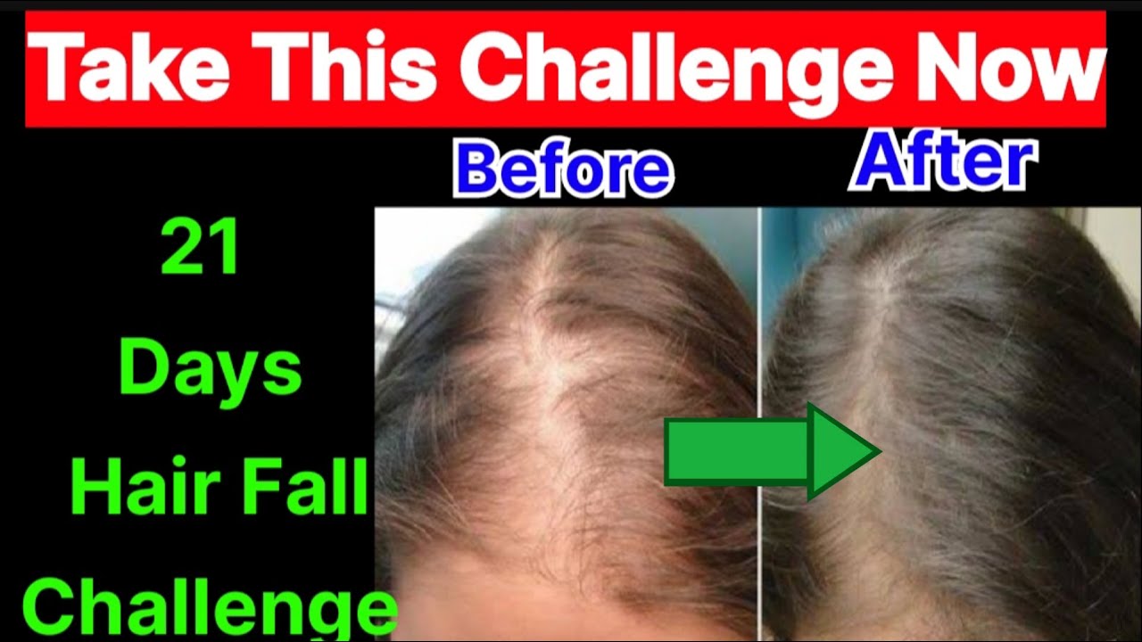 21 Days Hair Growth Challenge | 21 days Hair Fall Challenge - YouTube