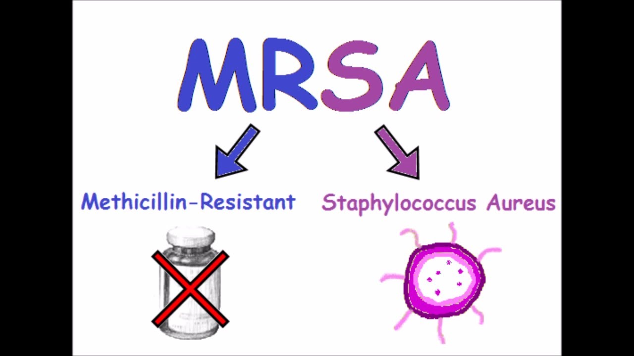 Manchester Leadership Programme: MRSA - The Basics - YouTube