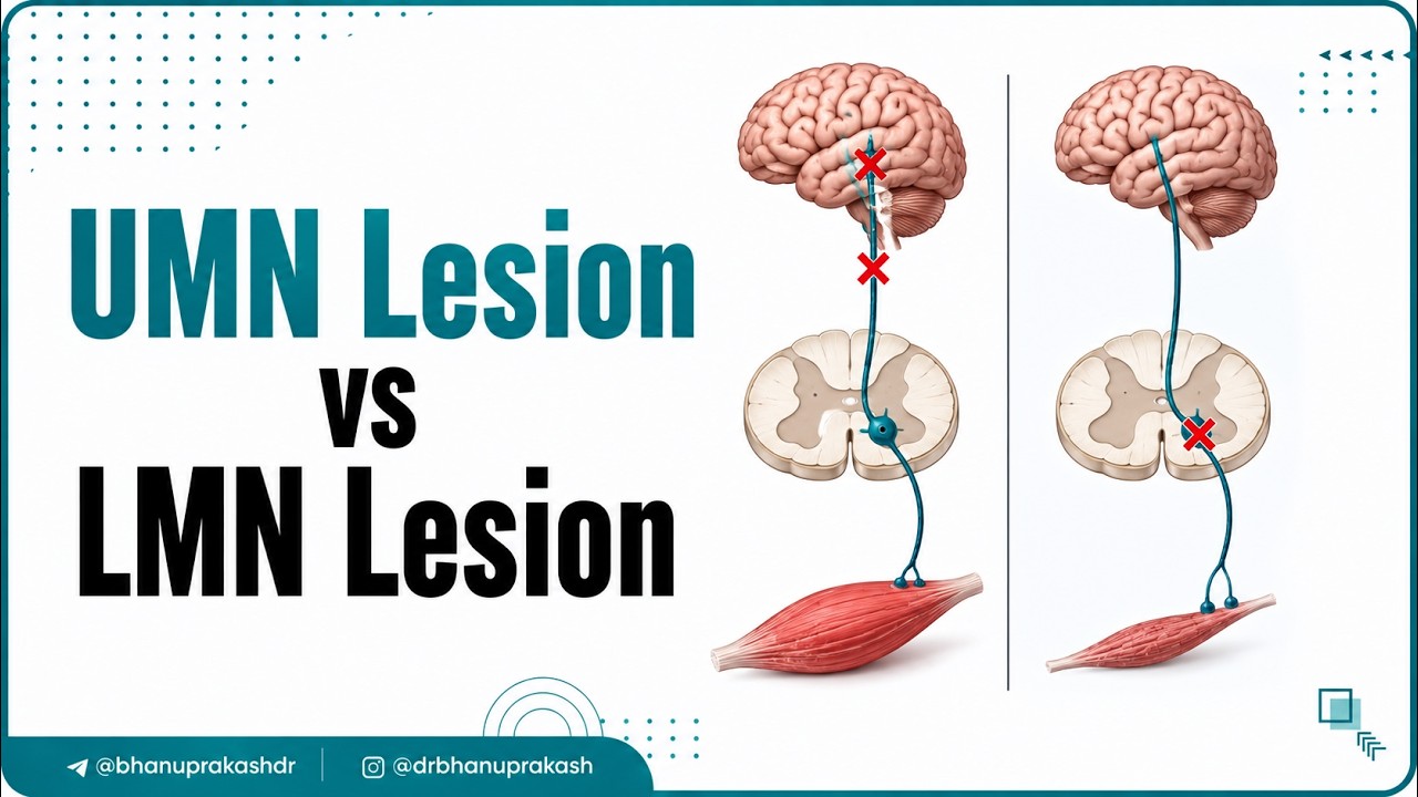 10. UMN Lesion vs LMN Lesion 🧠⚡ | Motor Nervous System Differences ...