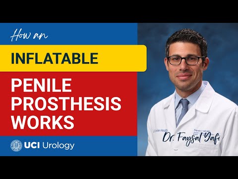 How an Inflatable Penile Prosthesis Works by Dr. Faysal A. Yafi - UCI Department of Urology