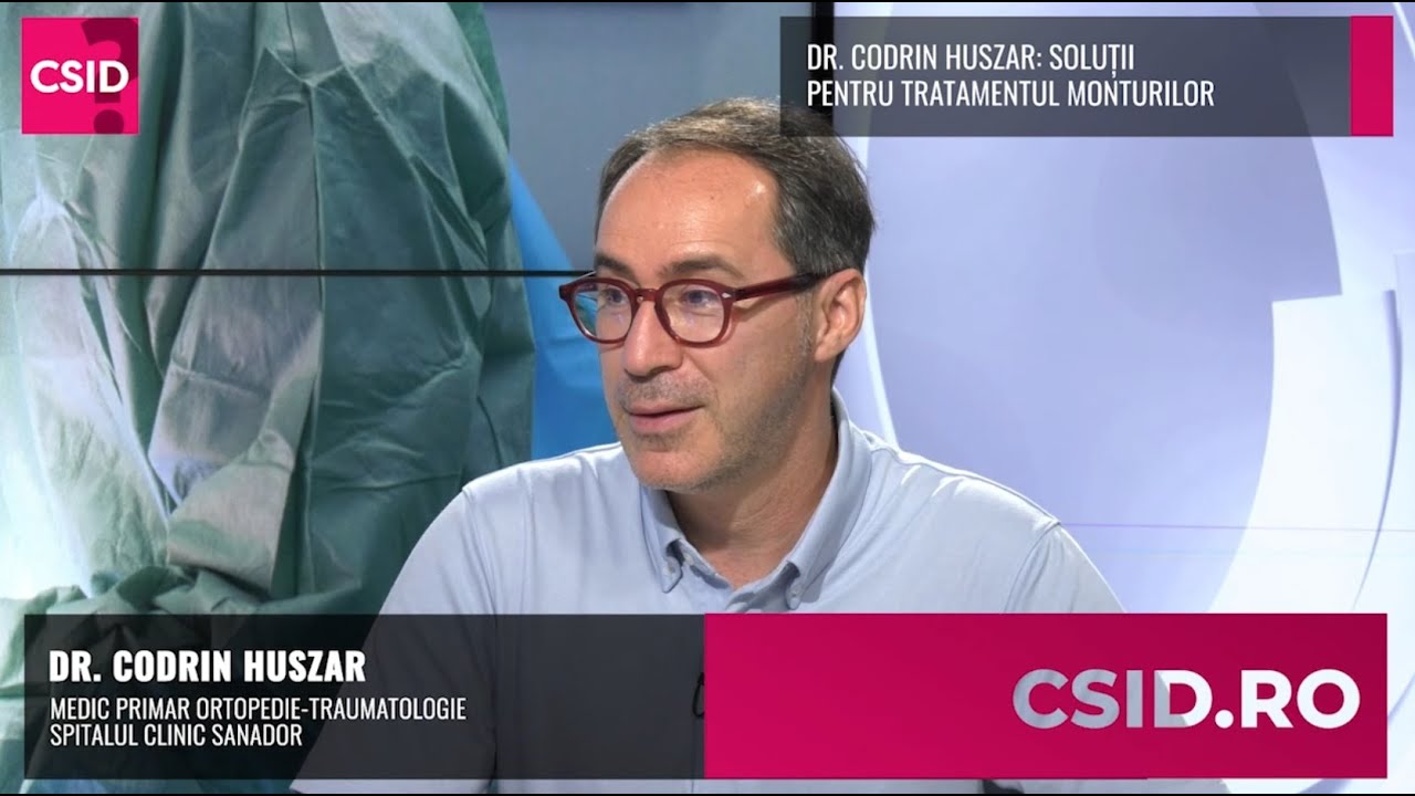 Tratamentul monturilor (hallux valgus) - Dr. Codrin Huszar | Spitalul ...