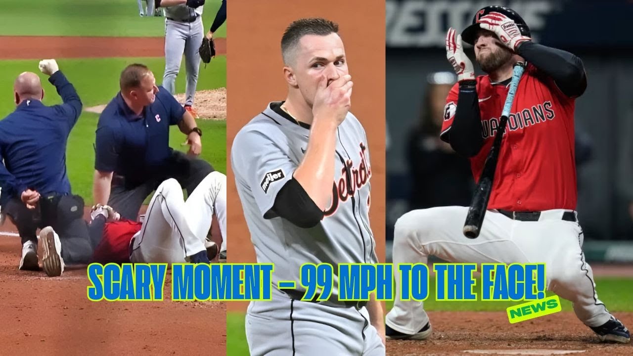 Scary Moment | Guardians’ David Fry Hit in Face by 99 MPH Pitch – Taken ...