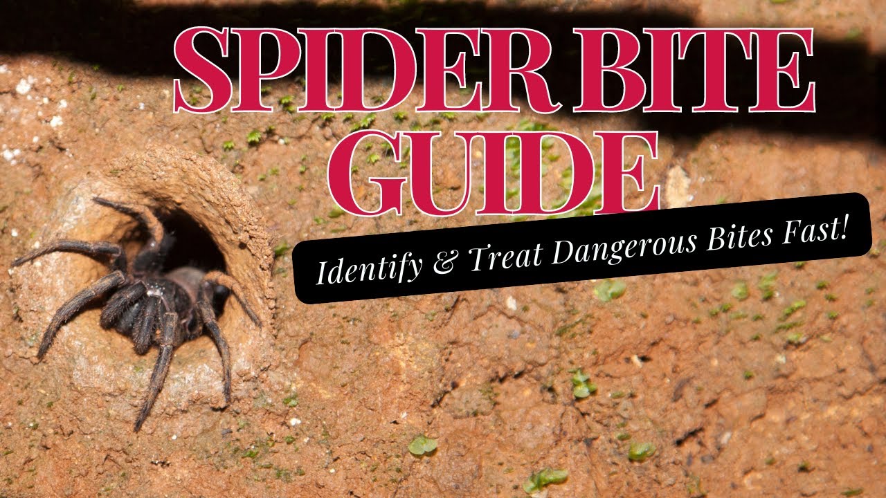 Spider Bite Guide: Identify & Treat Dangerous Bites Fast! - YouTube