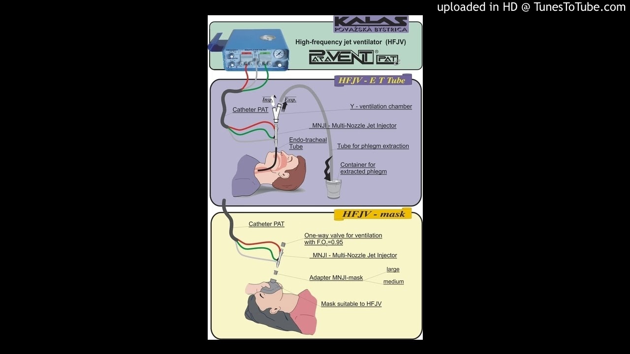 Jet ventilation in obese patients undergoing airway surgery for ...