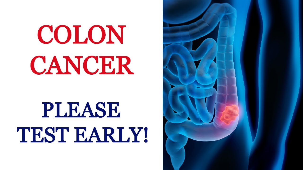 It Is Very Important To Test For Colon Cancer Yes You Should Test For it-is-very-important-to-test-for-colon-cancer-yes-you-should-test-for