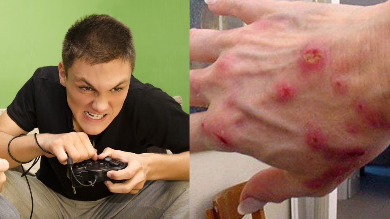 10 Medical Conditions Caused By Video Gaming || Pastimers - YouTube