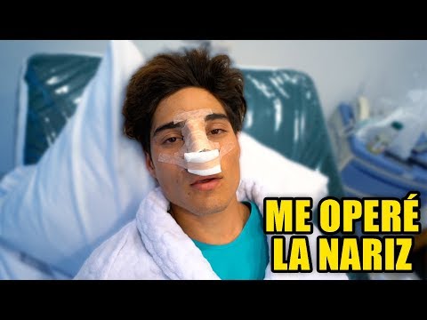ASÍ QUEDÓ MI NARIZ DESPUÉS DE LA OPERACION