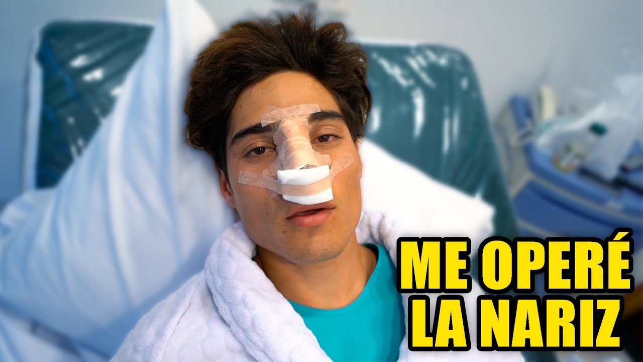 ASÍ QUEDÓ MI NARIZ DESPUÉS DE LA OPERACION - YouTube