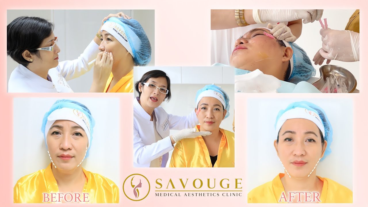 Rainbow Cogs: Instant Face Lift by Fiona Threads - YouTube