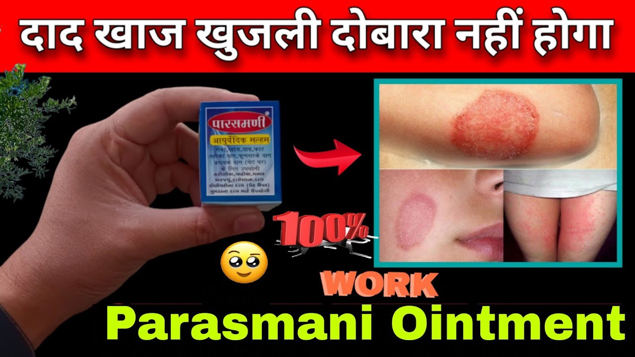 parasmani malam(दाद खाज खुजली दोबारा नहीं होगा) parasmani | parasmani ...