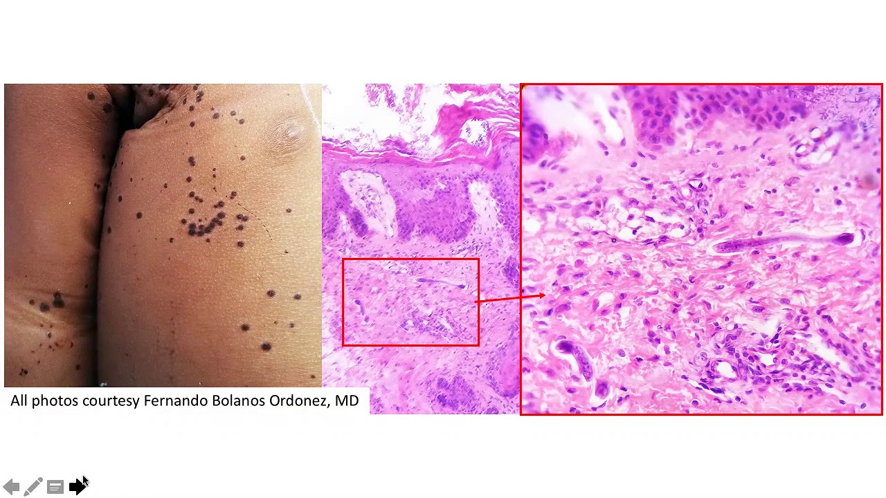 DP60 special episode courtesy Dr Ordonez - YouTube