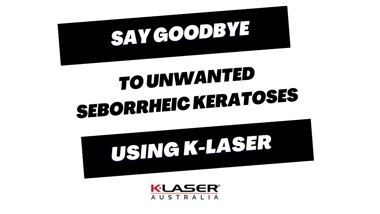 Say Goodbye To Unwanted Seborrheic Keratoses Using K-Laser Blue Derma ...