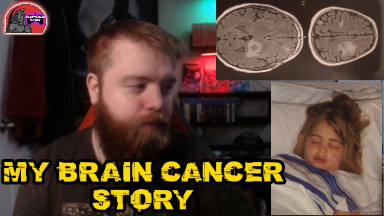 15 years ago I had (PTLD) Kidney Disease and Brain Cancer - YouTube