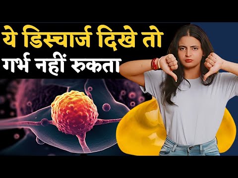 ये डिस्चार्ज दिखे तो गर्भ नहीं रुकता, जानिए क्यों ? Vaginal discharge & fertility - Youtube Saheli
