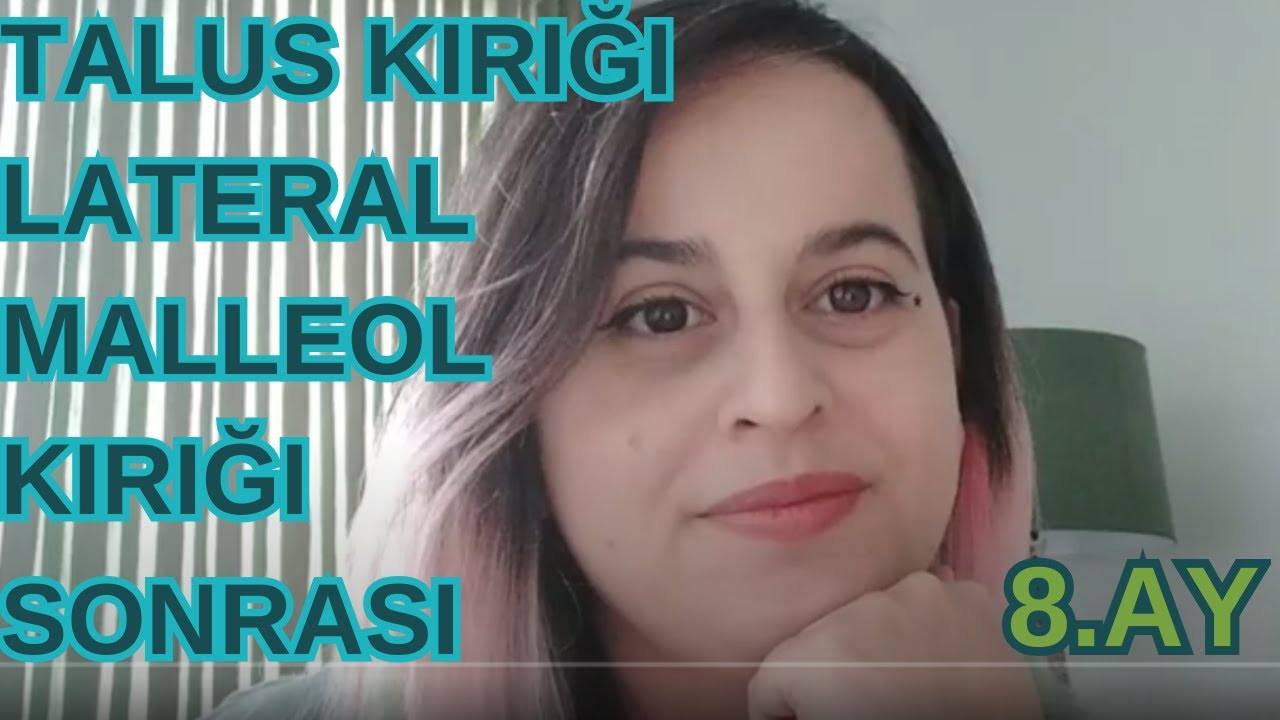 Talus Kırığı ve Lateral Malleol Kırığı sonrası 8. Ayım - YouTube