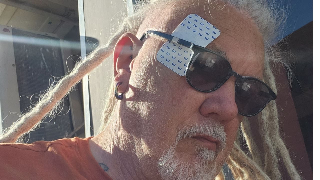 PJ Audits Gets A Black Eye - YouTube