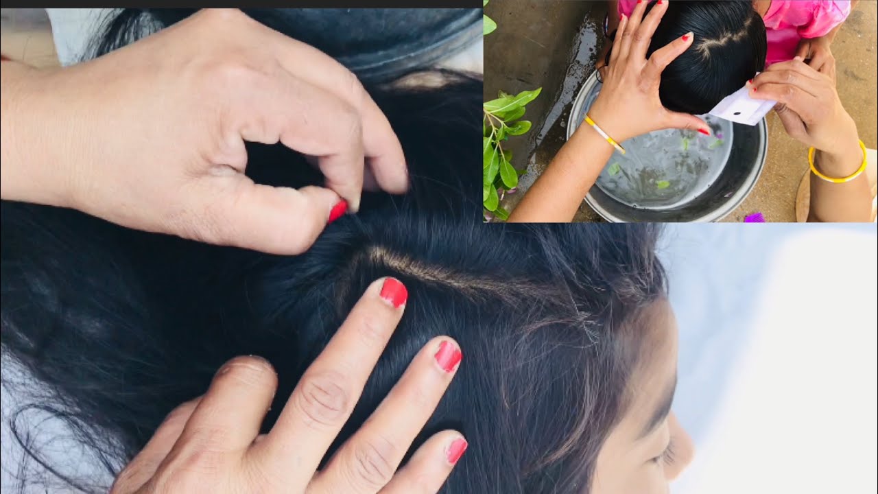 June aur Likhe Nikalne ka Desi Tarika Lice And Nits Remove at Home # ...