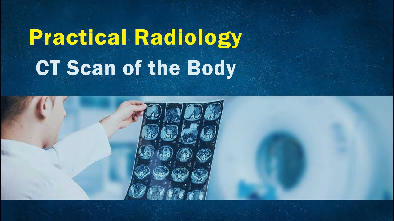 Practical Radiology | CT Scan of the Body - YouTube