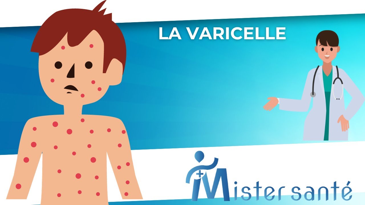 Que faire si mon enfant a la varicelle ? - YouTube