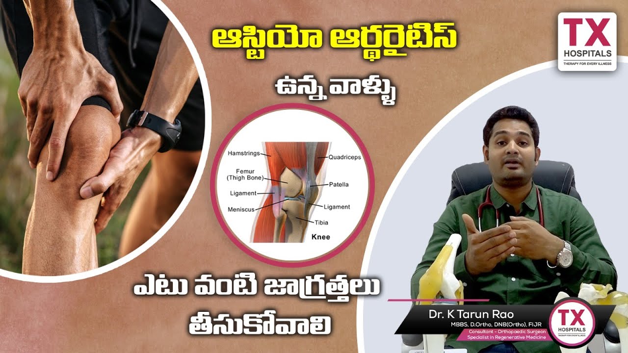 The Arthritis Weight Factor: How BMI Influences Joint Health || Dr ...