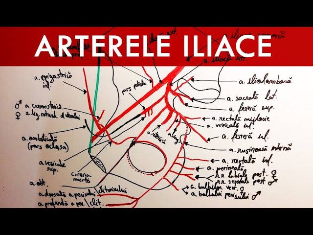 Iliaca Externa Schematic Of Local Catheter. Stream Of The Injected