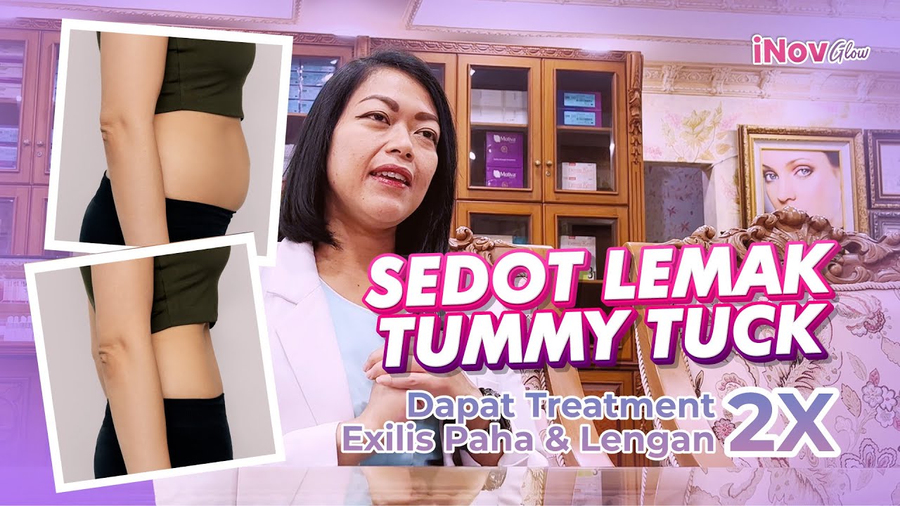 Bebas dari Lemak Perut Berlebih dengan Sedot Lemak Tummy Tuck di Inov Glow - YouTube