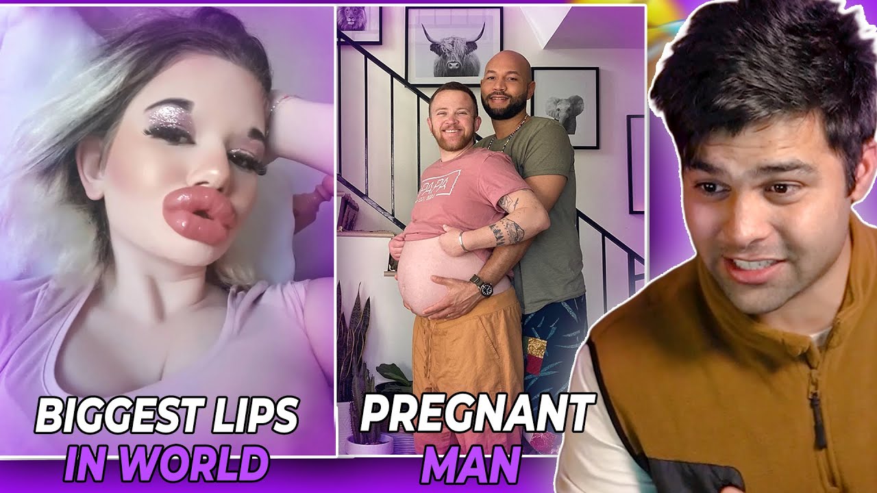 Rarest and Most Unique People on Earth 😳 (One In a Million) - YouTube