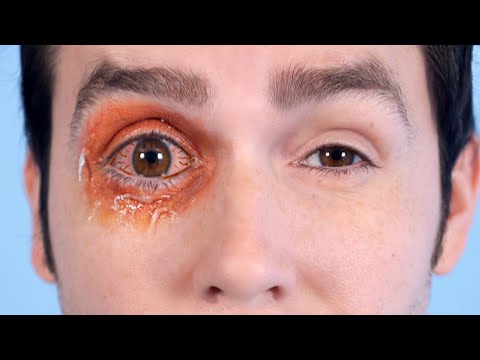 PINK EYE SURPRISE!